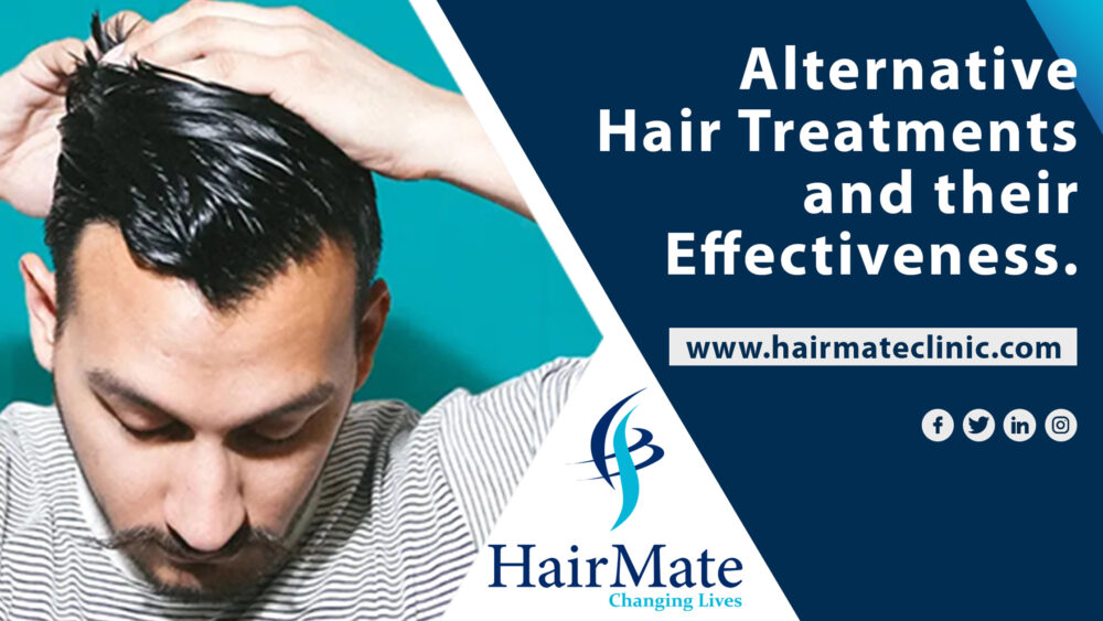 Hairmate Clinic Hair Transplant Clinic In India Hairmate Delhi